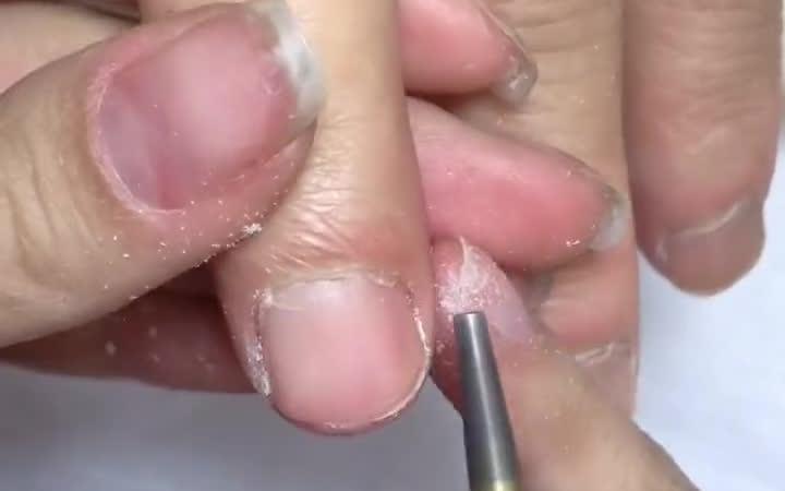 这死皮去的太爽了,有没有喜欢去死皮的ߘ