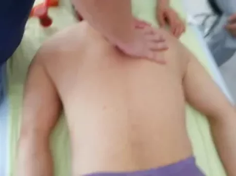 按摩背部治疗颈椎病 治疗颈椎最快的方法 中医推拿颈椎病