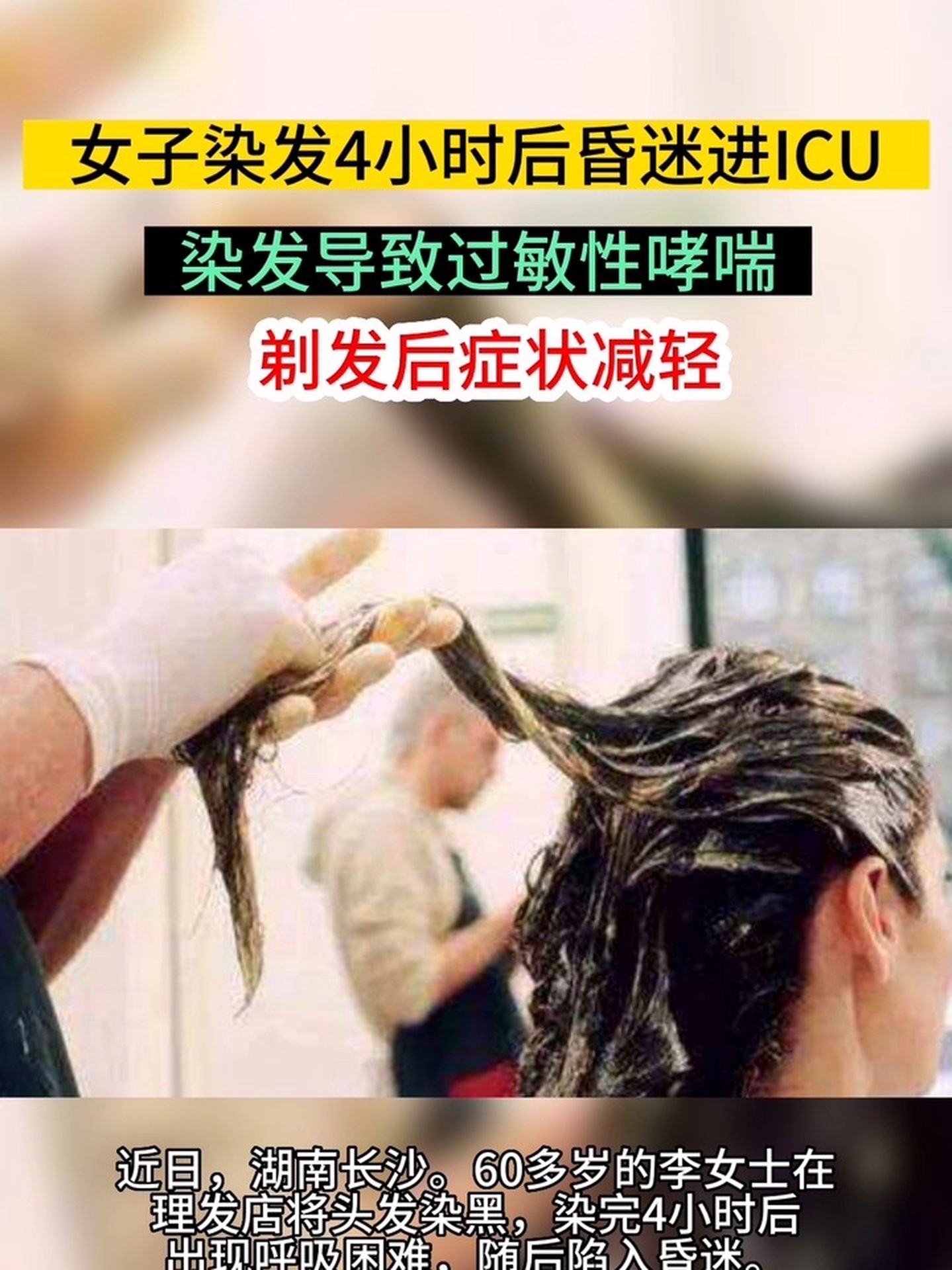 女子染发4小时后昏迷进ICU染发导致过敏性哮喘剃发后症状减轻