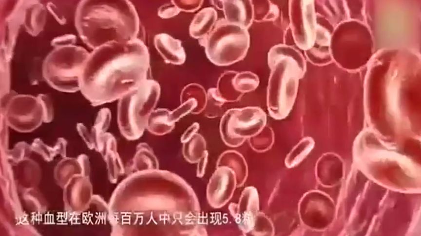 熊猫血算什么稀奇,这种血型全世界只有一例!在中国!