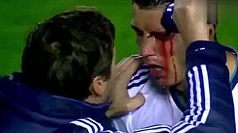 超燃! C罗励志过往: 曾经叛逆少年, 如今足坛之王, 总有一条感动你