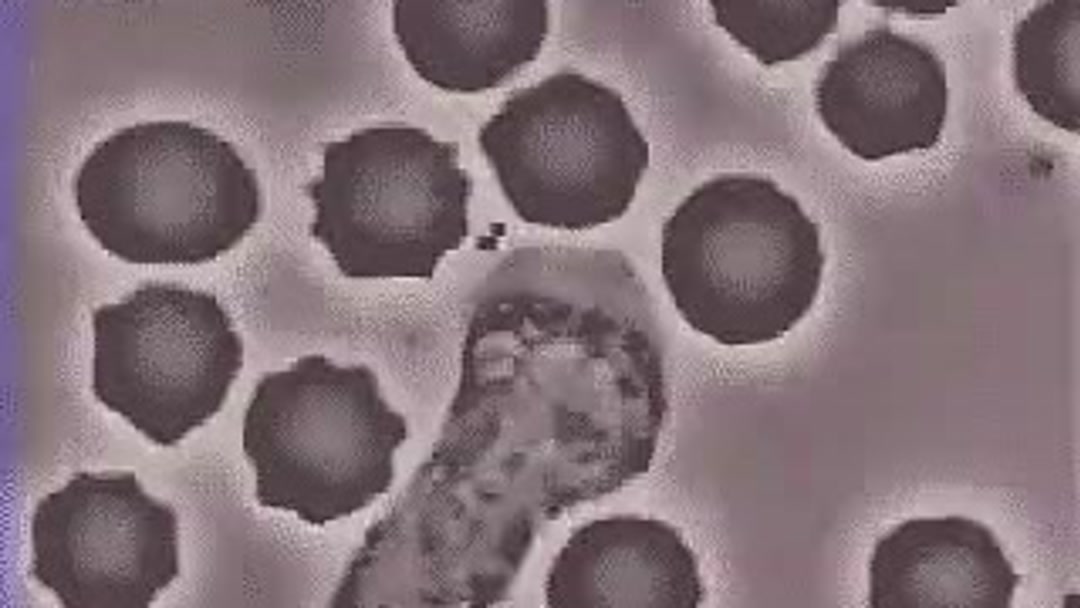 白细胞追杀病菌