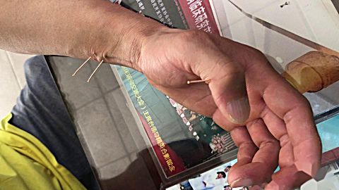 梁若健老师用董氏奇穴一针疗法治疗手指关节冷痛立效!