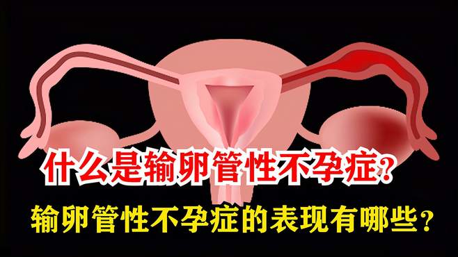 什么是输卵管性不孕症?输卵管性不孕症的表现有哪些?