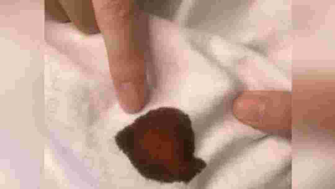 衣服或者床单上的血渍怎么清除干净