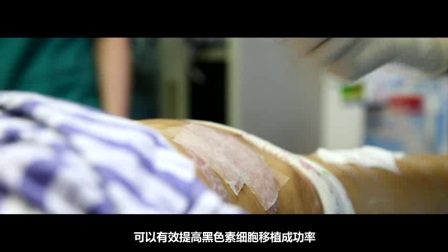 白癜风表皮移植治疗
