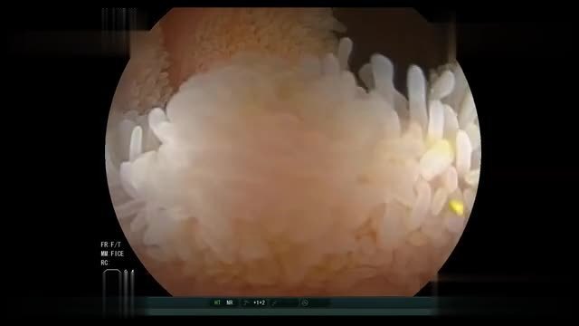 将高分辨率摄像头插入菊花,能拍到怎样的画面?