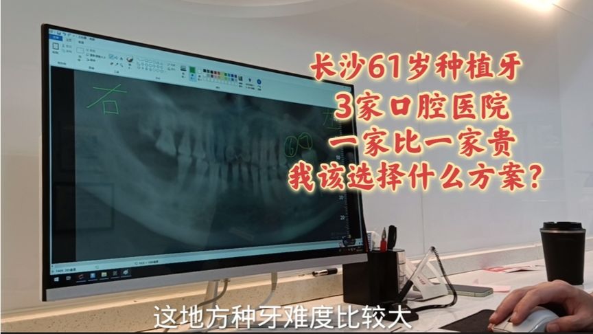 长沙61岁种植牙,3家口腔医院一家比一家贵,我该选择什么方案?