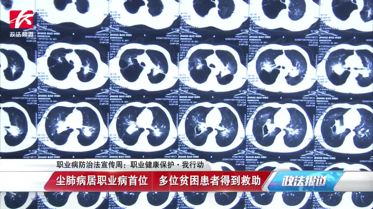 “尘肺病”居职业病首位,专家提示:需高度重视及做好防治工作