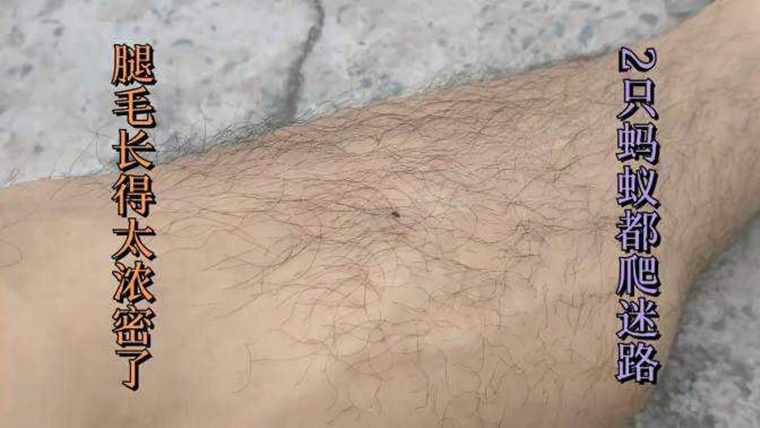 小伙的腿毛长得太浓密了,分别把2只蚂蚁放到上面爬行,都爬迷路了