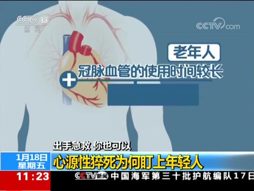 [新闻直播间]出手急救 你也可以 心源性猝死为何盯上年轻人