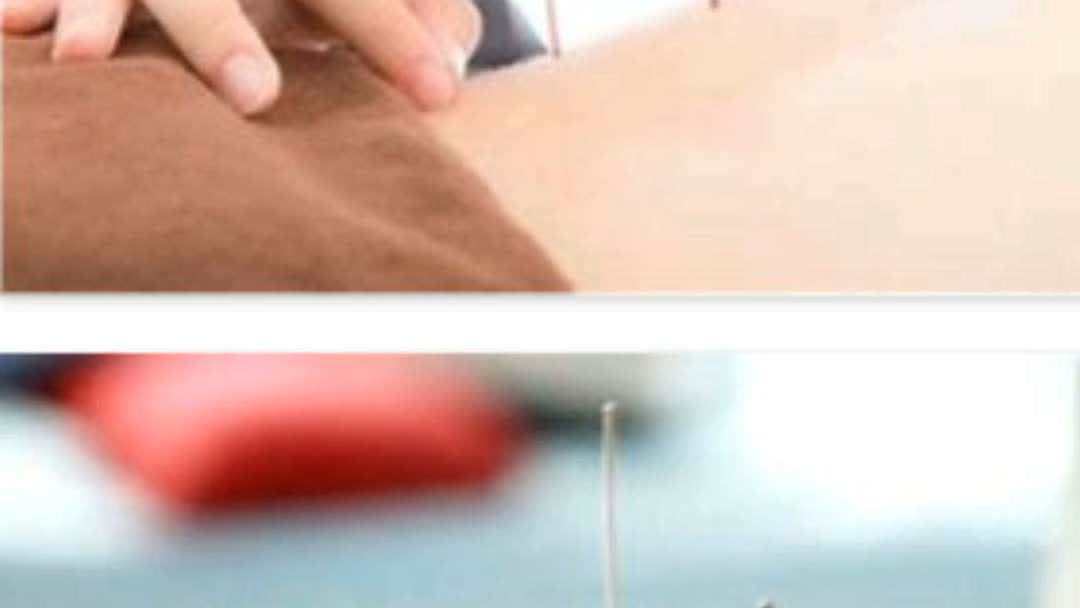 南京王自平小针刀 椎间盘针火针埋线浮针骨减压针拨针 教学视频