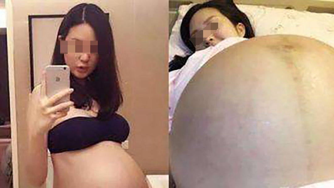 神奇!怀双胞胎孕肚大一倍