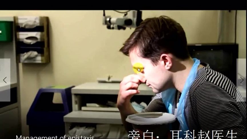医生处理鼻出血的几种常用方法