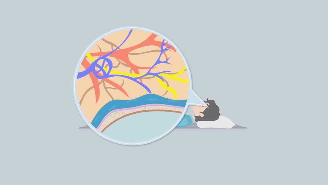 脑血栓和脑梗塞分别指什么?那个更加危险?看专家怎么说