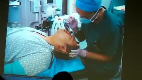 经鼻气管盲插管