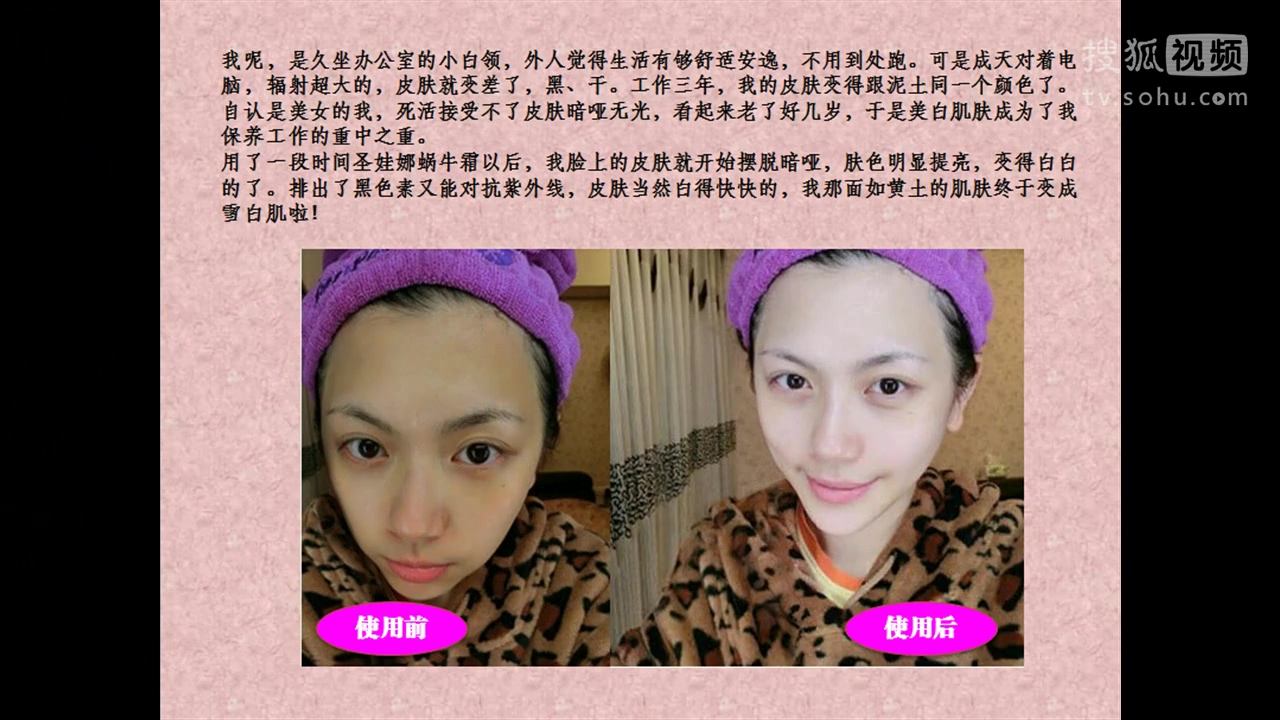 什么牌子的蜗牛霜祛痘痕管用_媛寇蜗牛霜作用如何