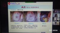 宫颈疾病疑难病例讨论会