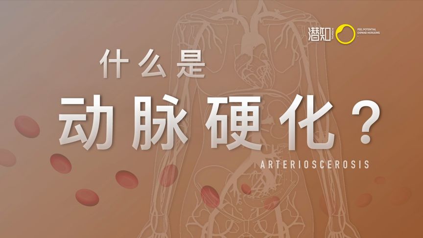 什么是动脉硬化?