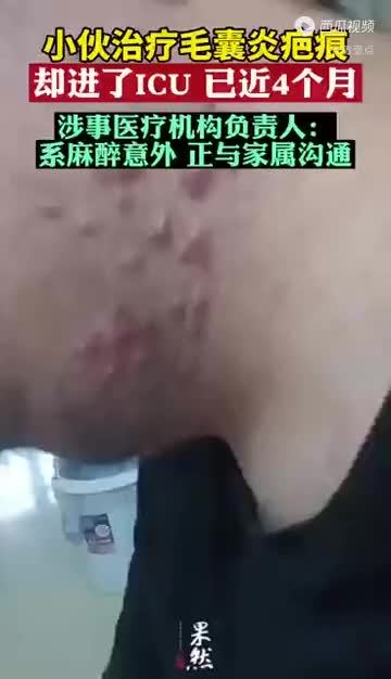 小伙治疗毛囊炎疤痕,却进了ICU,已近4个月 涉事医疗机构负责人:系麻醉...