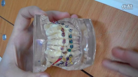 正畸模型展示(2)