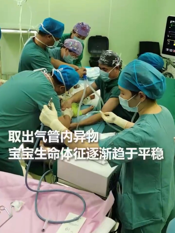 婴儿气管卡入异物医护狂奔救回孩子
