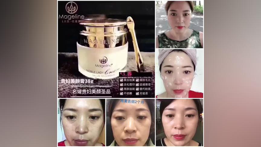 每天坚持护肤打卡:贵妇美颜膏美白.去斑,去黄色,去痘印