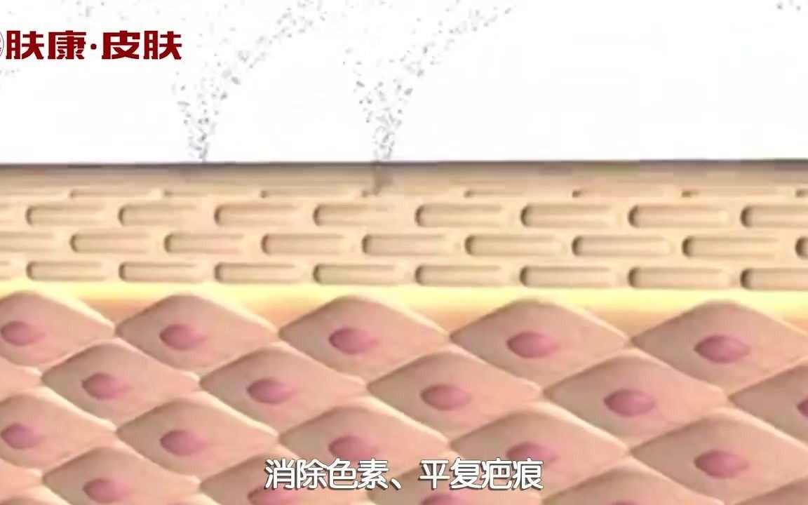 在线解析:常见的疤痕类型及治疗方法