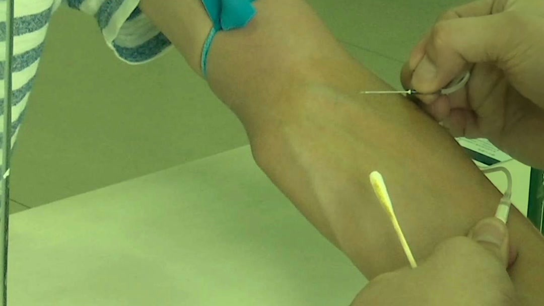 厉害了! “飞针”医生创造10秒急速“无痛抽血”