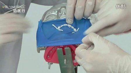 佰医行牙科橡皮障操作视频2