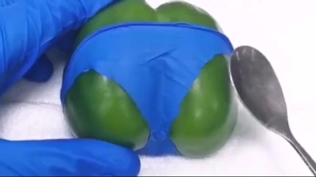 带你们近距离看看,痔疮是怎么进行手术的。ߘ�ߘ�ߘ