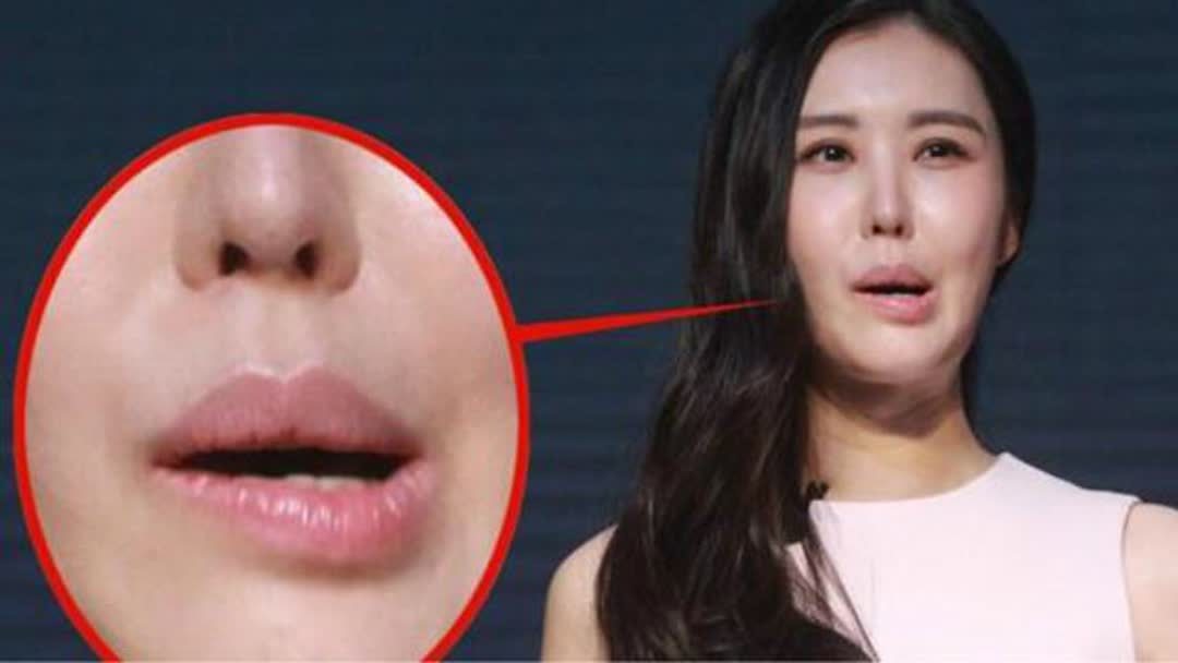 整容都有哪些副作用