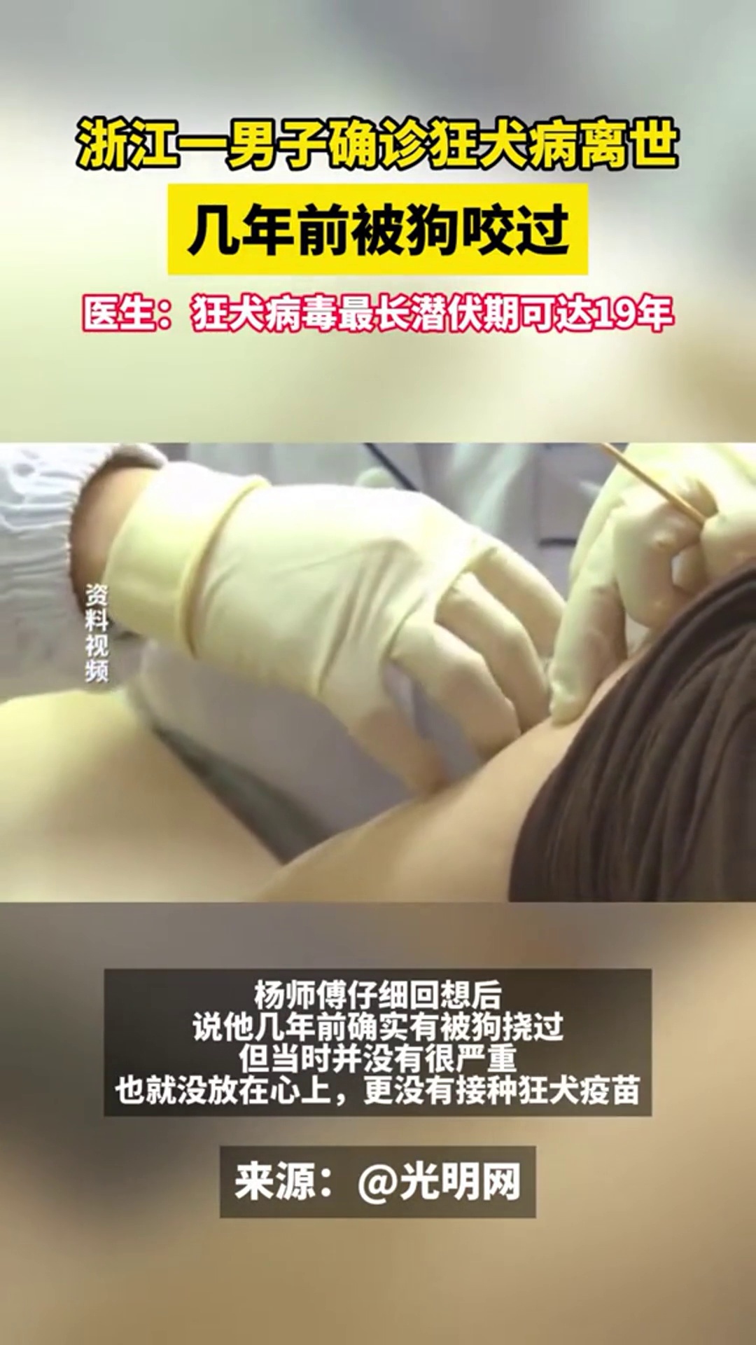 浙江一男子确诊狂犬病离世,几年前被狗咬过医生:狂犬病毒最长潜伏期...
