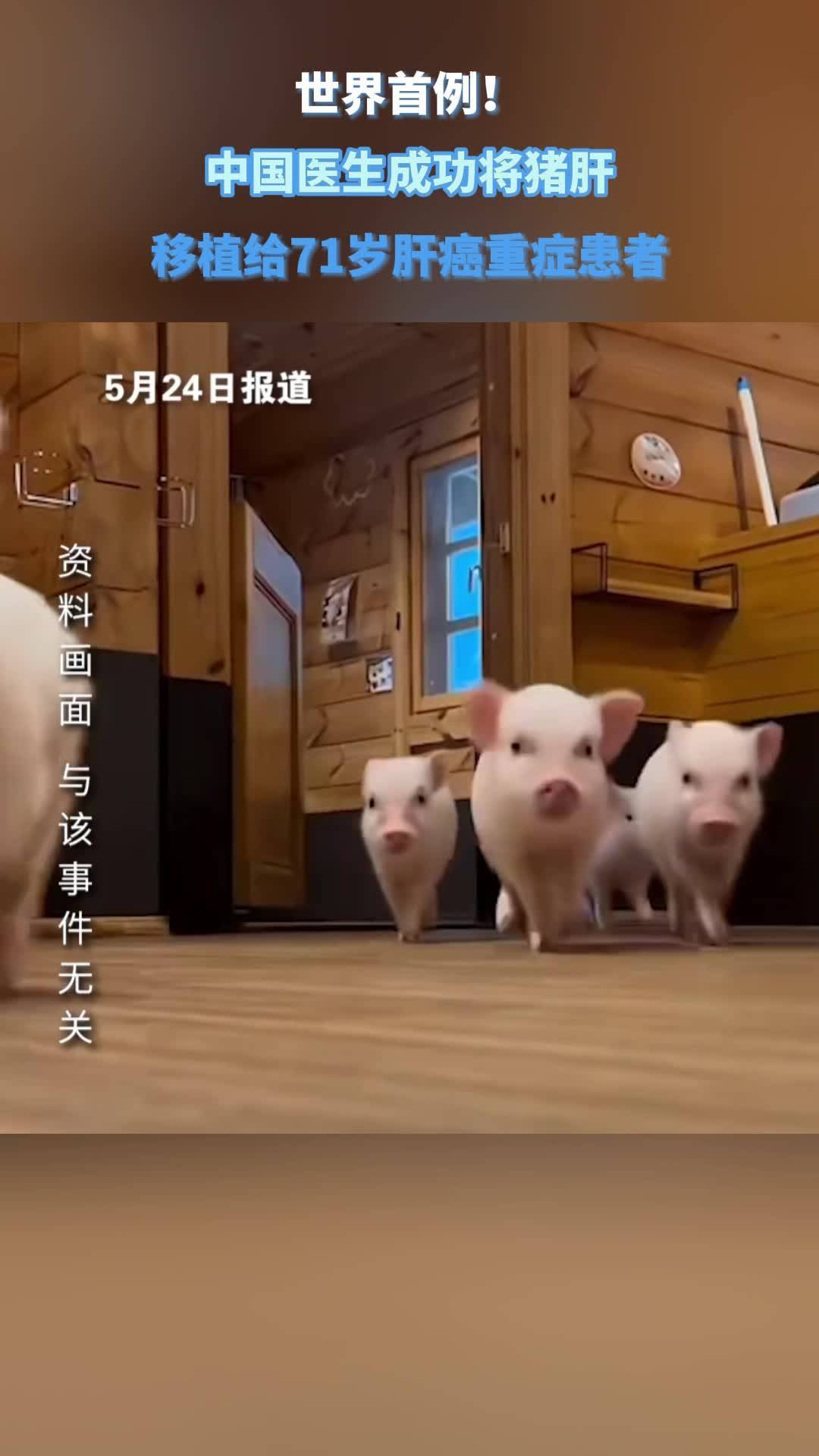 中国医生成功将猪肝移植给71岁肝癌重症患者