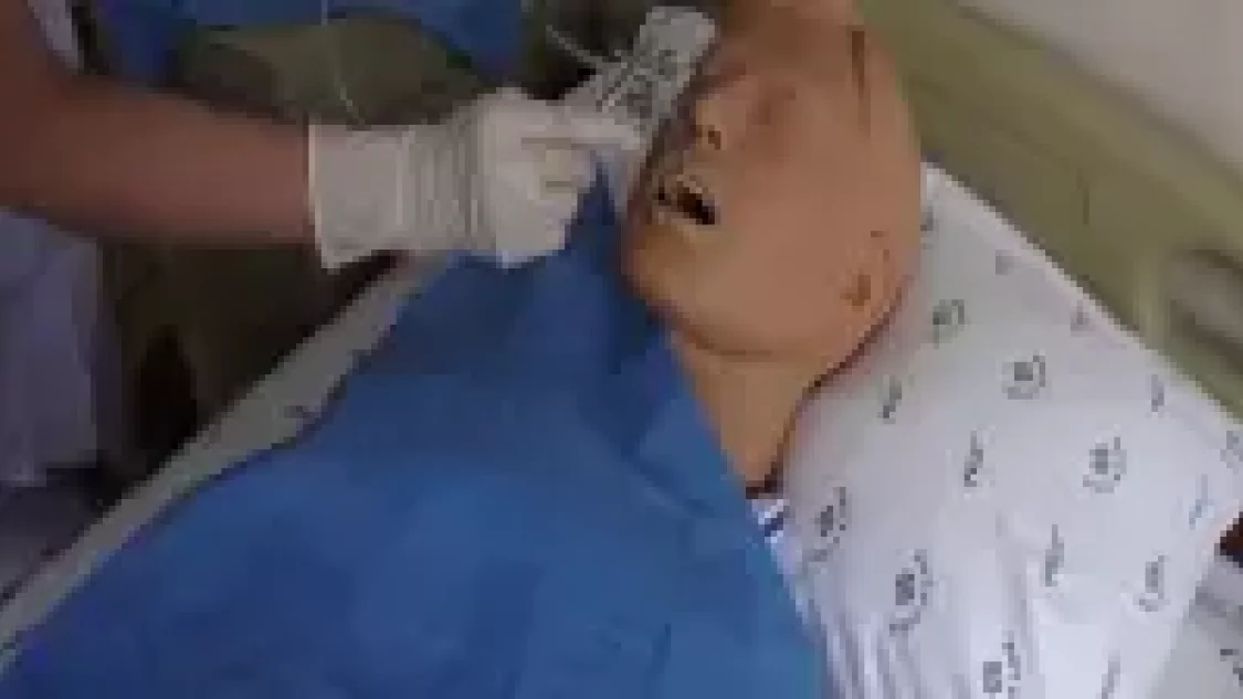 留置胃管术(鼻饲法)1