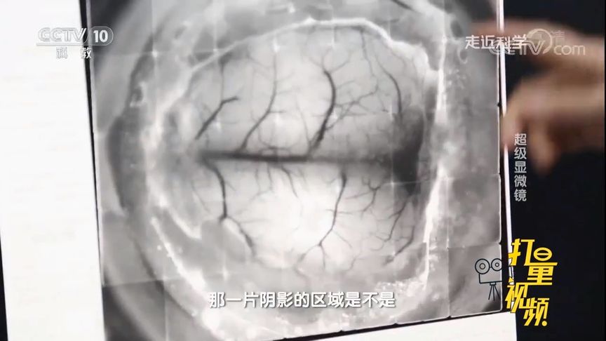 超级显微镜太抢手,多个科研团队排队使用,有何用途?|走近科学