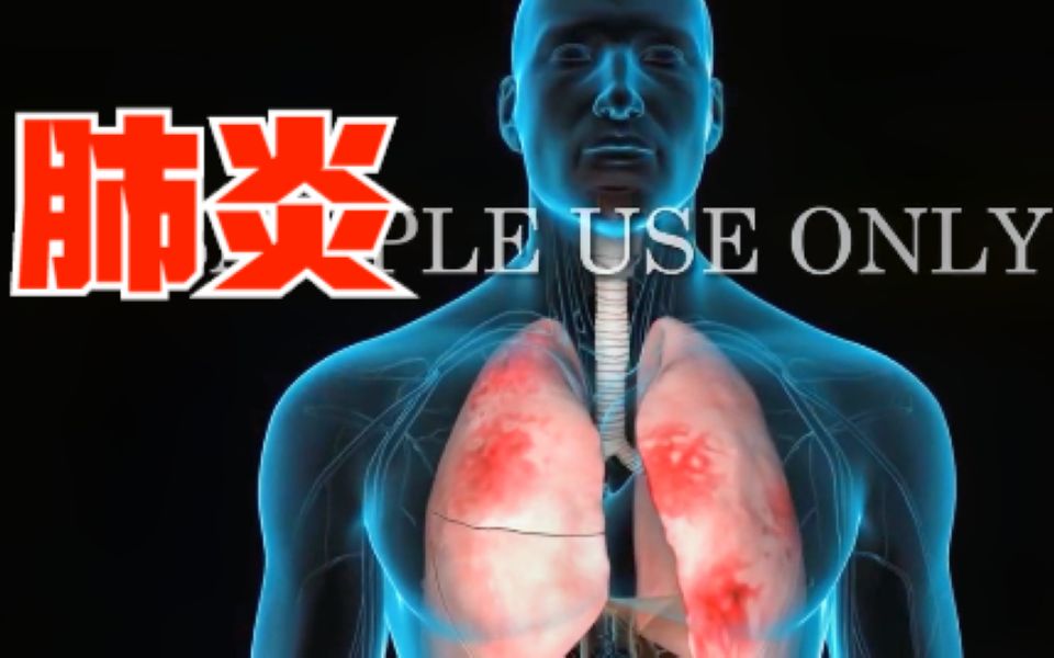 【中英字幕】医学3D动画:肺炎Pneumonia