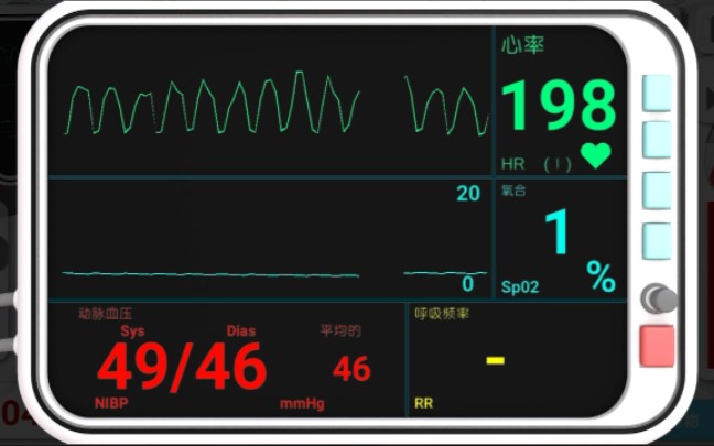 【医疗模拟器】室颤抢救过晚导致停搏后抢救
