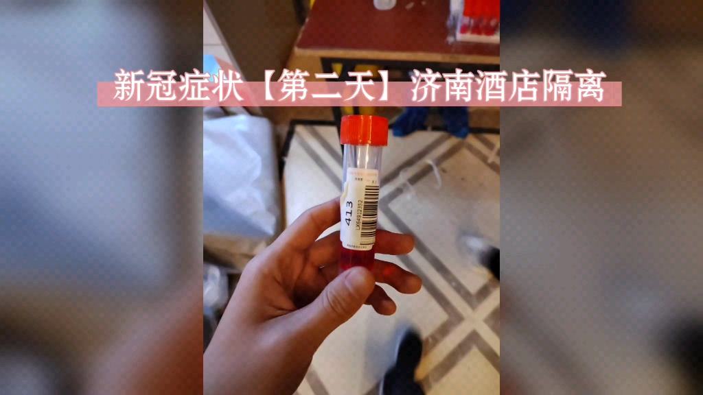 新冠症状【第二天】济南酒店隔离