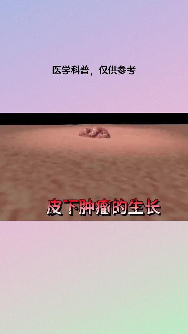 3D动画演示:肿瘤细胞的生长#肿瘤#医学科普#微观世界#肿瘤科普