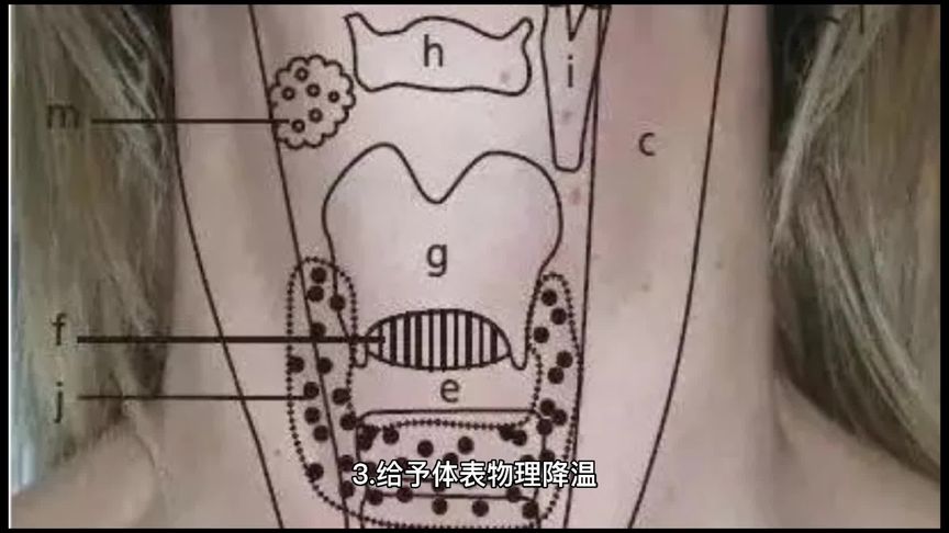 #知识科普 #中暑抢救流程