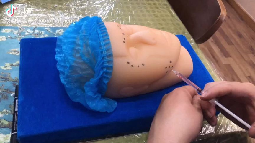 肉毒素注射,勤能补拙啊。