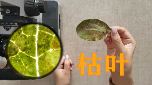 一片落叶放显微镜下看,有惊喜有沧桑,如同垂暮的老人