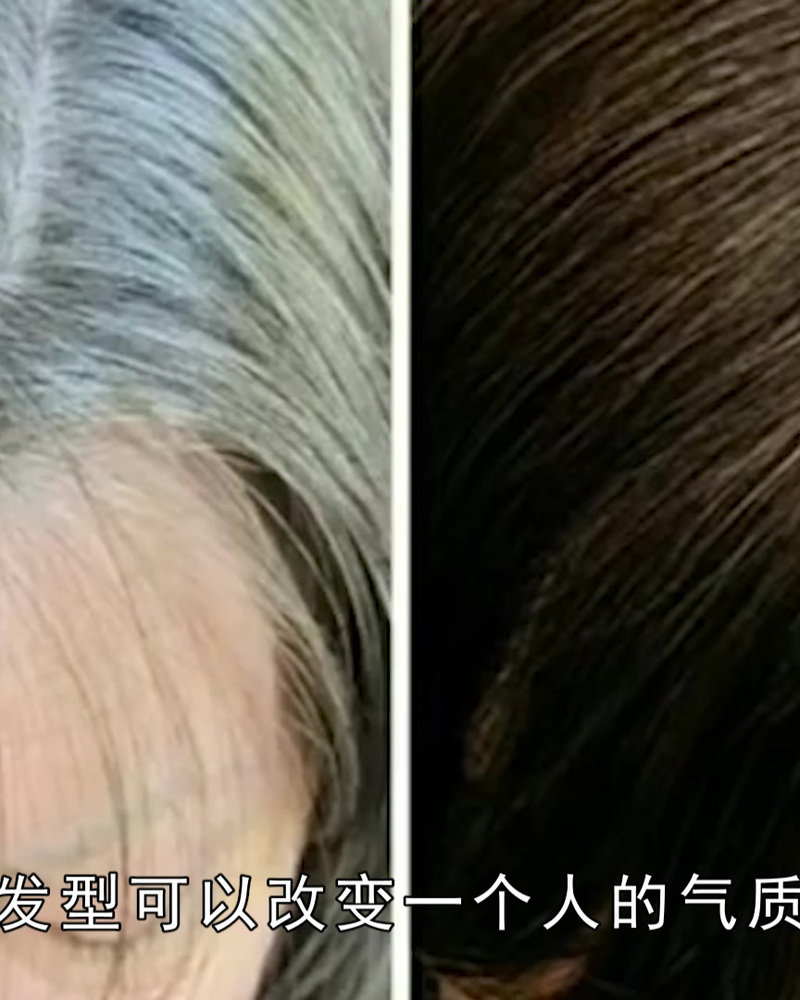 脱发严重还毛躁?用柠檬加它涂一涂,不仅能去屑还很柔顺