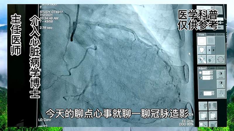 冠脉造影-冠心病诊断的“金标准”