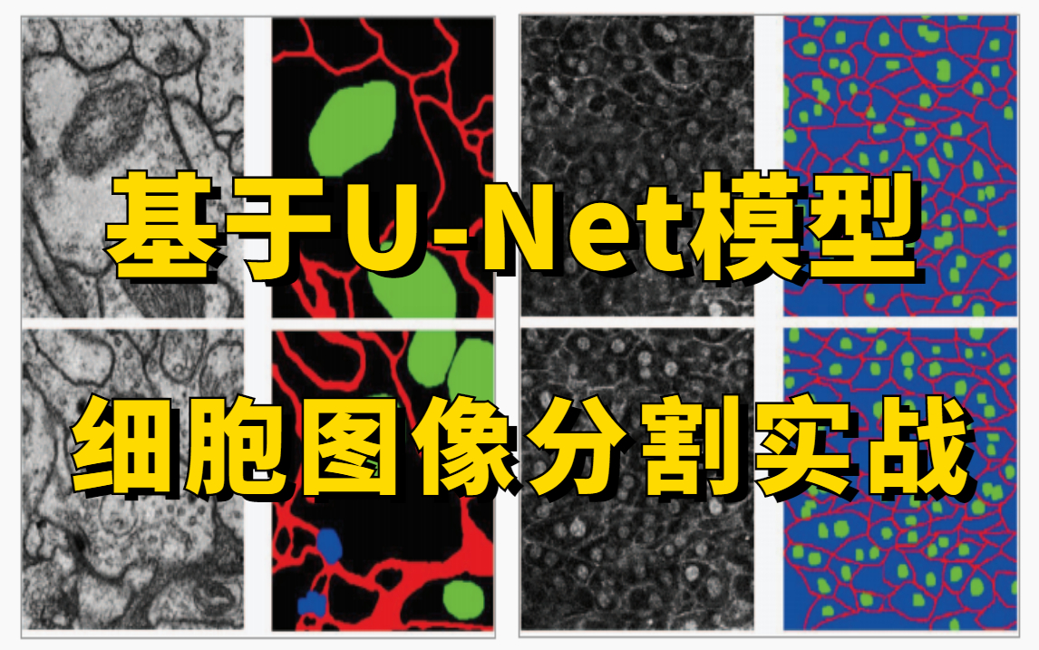 医学图像分割实战:基于U-Net模型实现细胞图像分割,原理详解+项目...