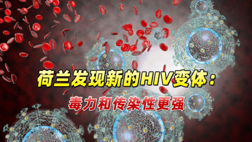 荷兰发现了新的艾滋病病毒(HIV)毒株:毒力更强,更具传染性