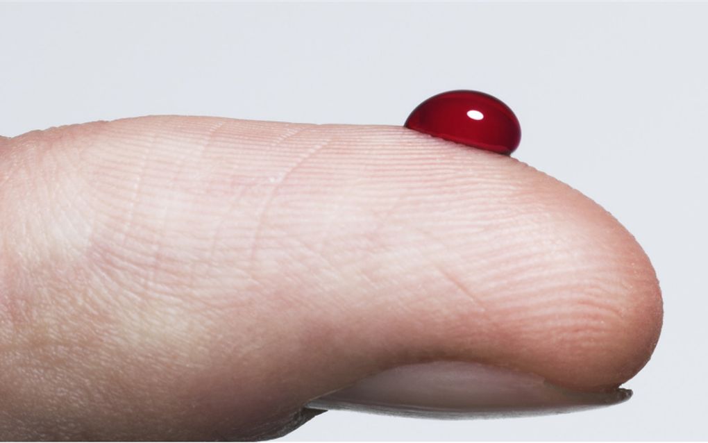 人死亡后,身体内的血液最后都跑到哪去了?看完整个人都不好了