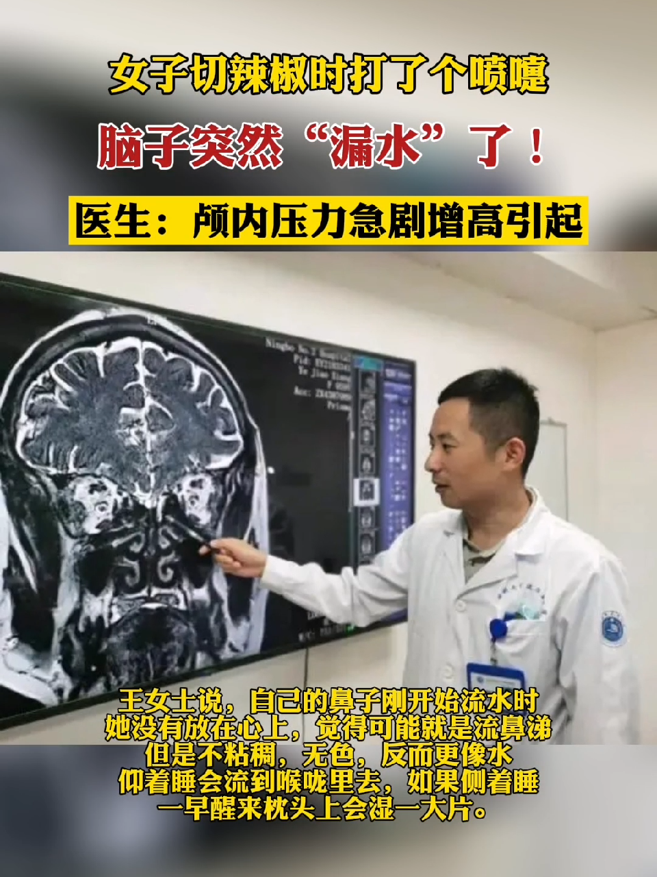 ,女子一查竟是脑子"漏水"了…