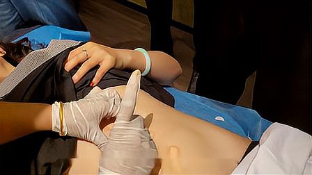 长效针灸穴位埋线疗法非药物疗法